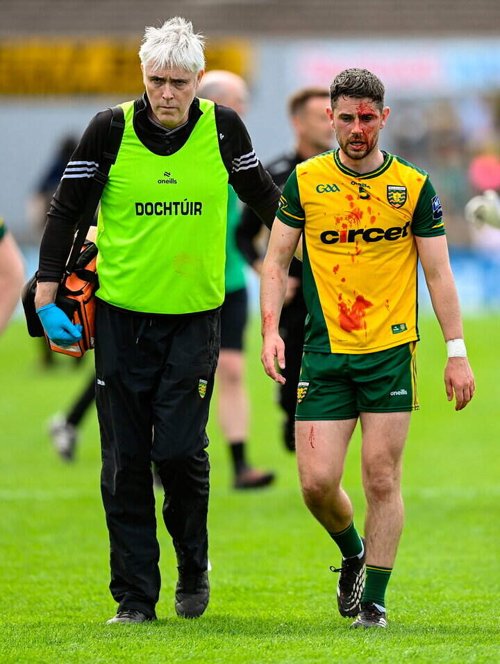 Donegal vs Kerry fight: GAA red card, Jim McGuinness ban risk | Belfast ...