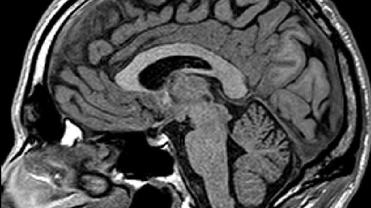 Brain region stimulated by beauty | Belfast Telegraph