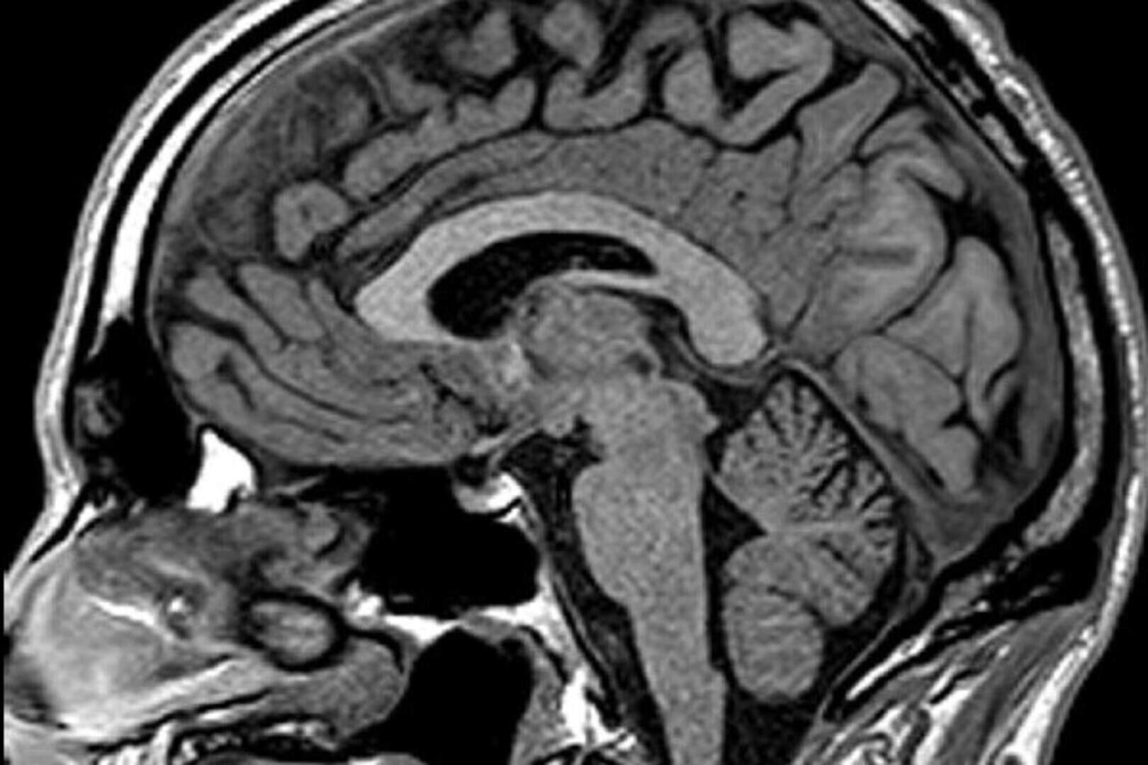 Brain region stimulated by beauty | Belfast Telegraph