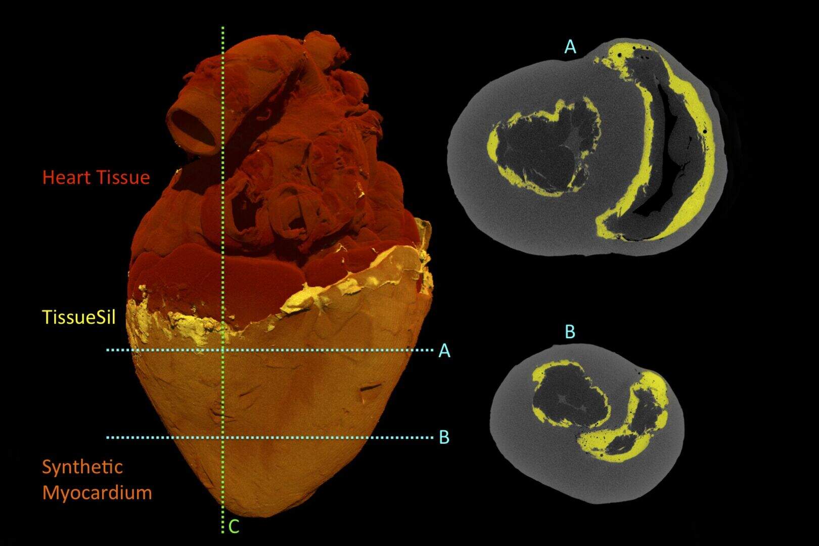 Engineers design bionic ‘heart’ that beats like the real thing ...