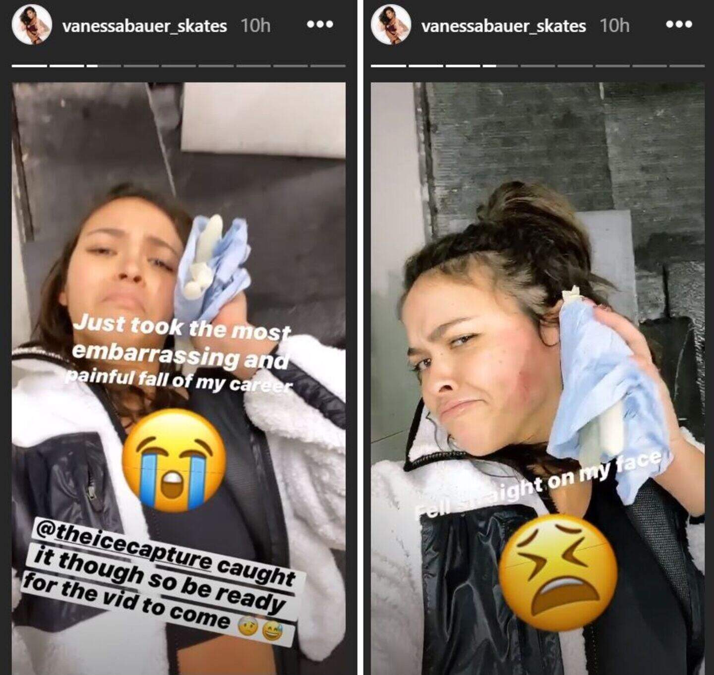 Dancing On Ice professional Vanessa Bauer injures her face in skating ...